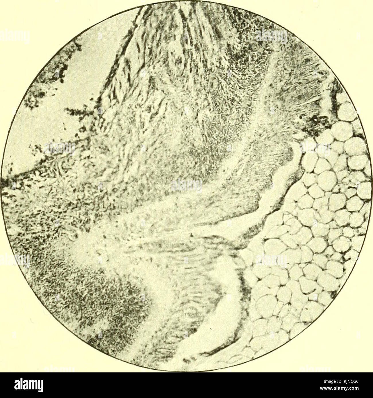 . Pathology and bacteriology [electronic resource]. Ophthalmology; Eye ...