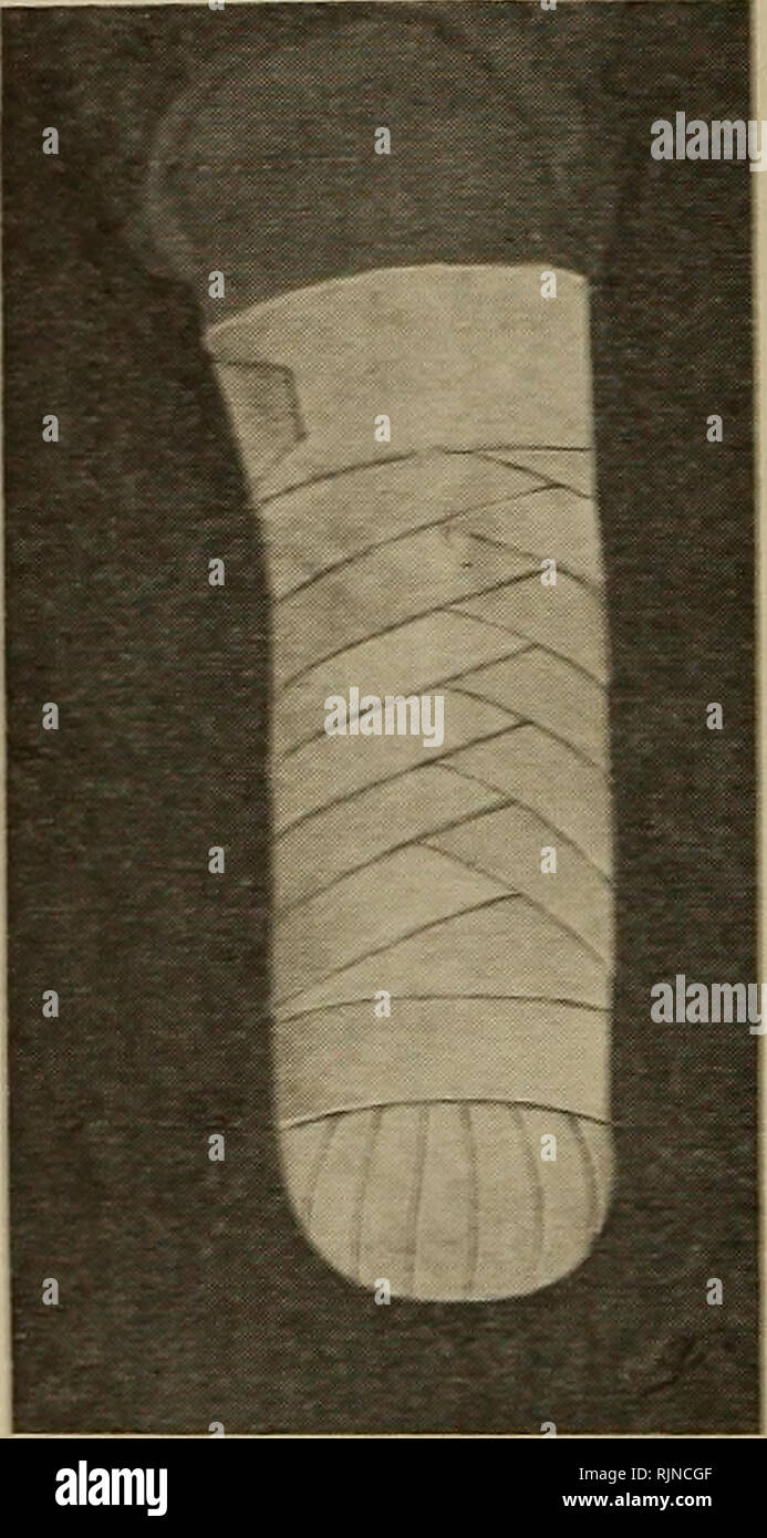 . Bacteriology and surgical technics for nurses. Surgical nursing ...