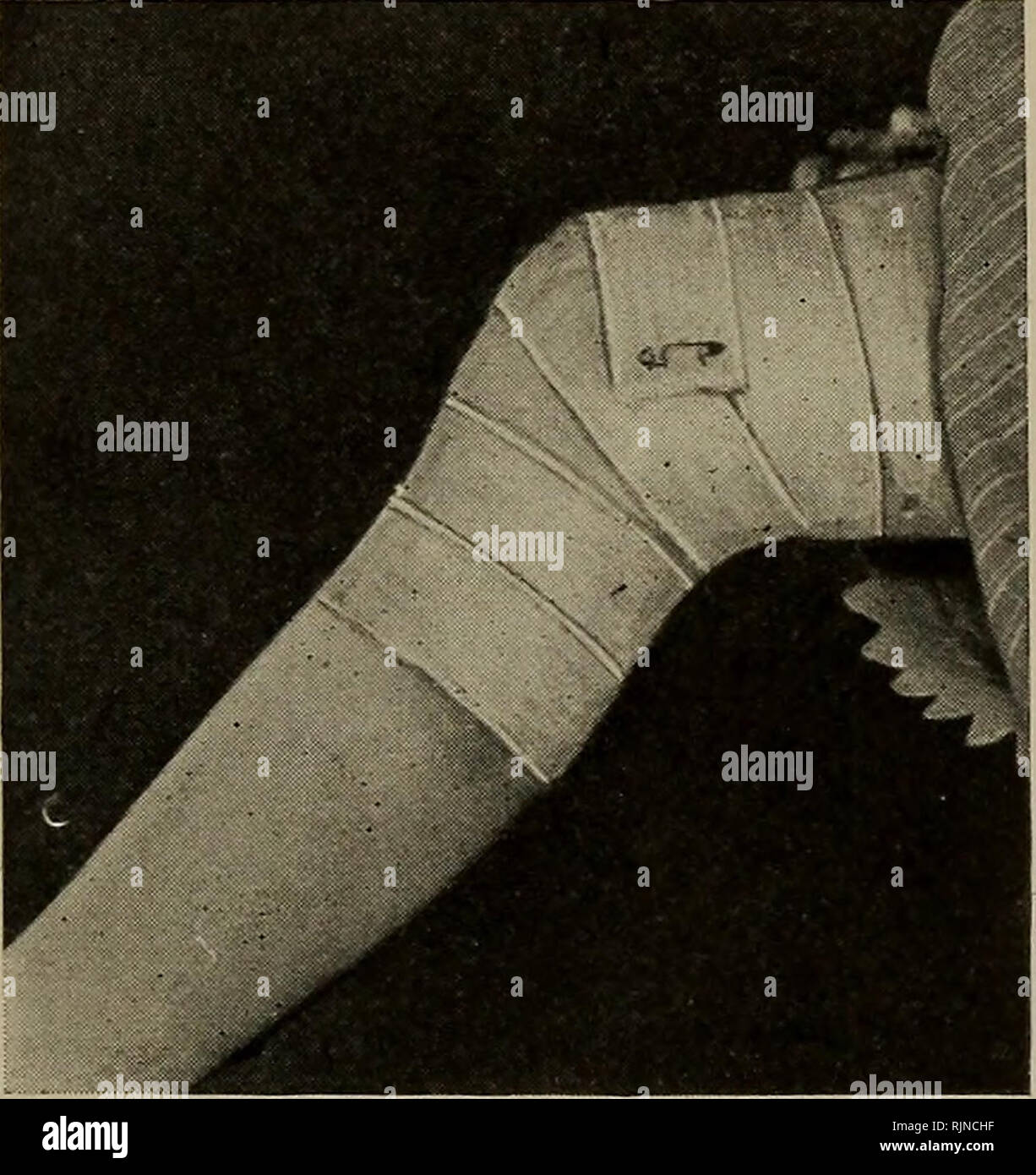 . Bacteriology and surgical technics for nurses. Surgical nursing ...