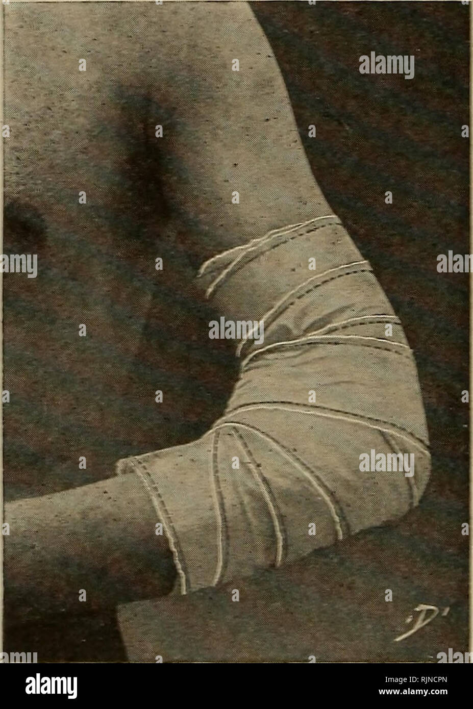 . Bacteriology and surgical technics for nurses. Surgical nursing ...