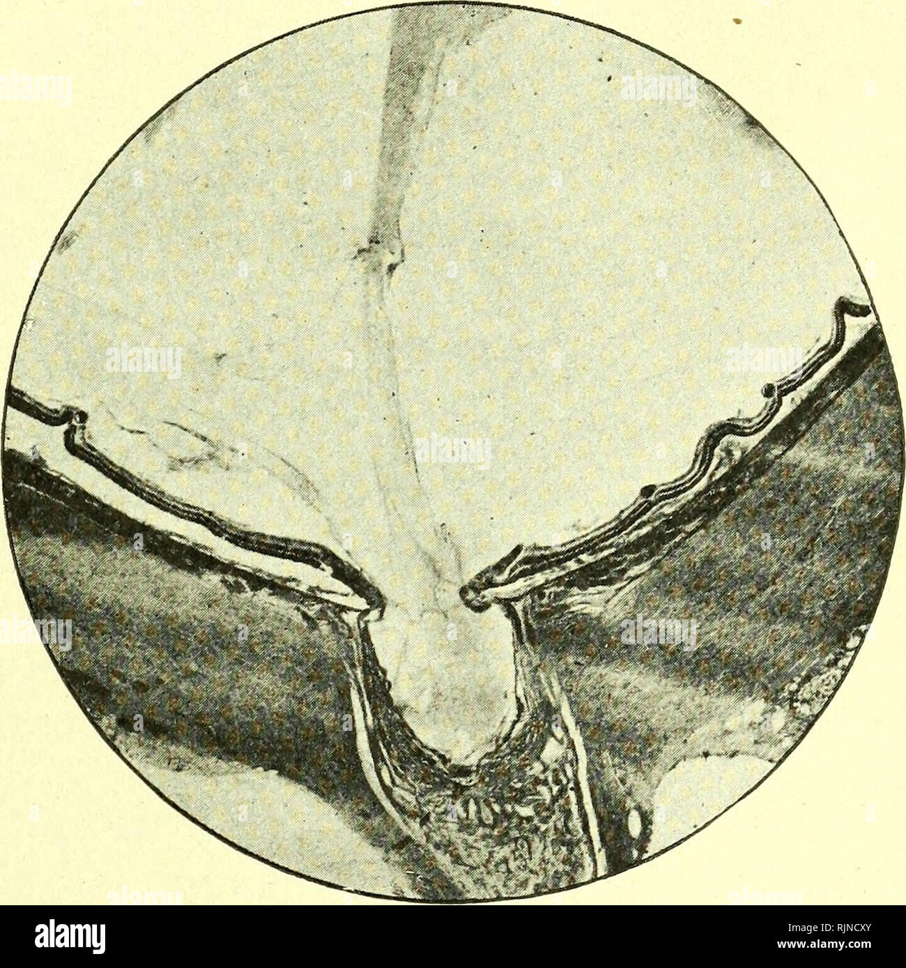. Pathology and bacteriology [electronic resource]. Ophthalmology; Eye ...