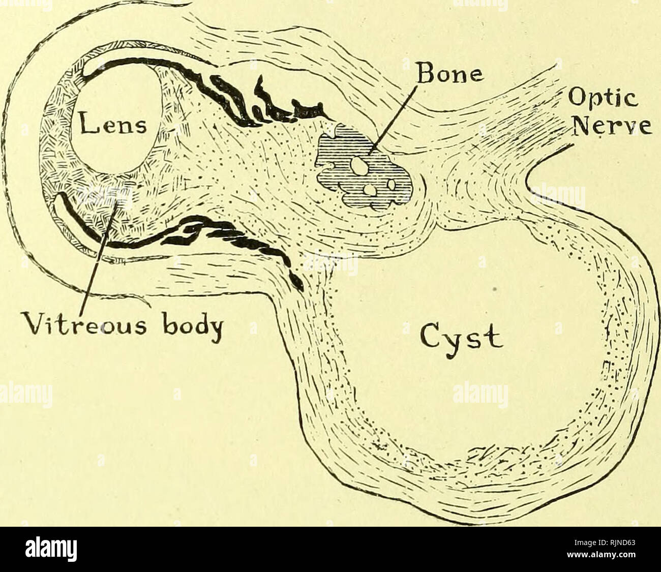 . Pathology and bacteriology [electronic resource]. Ophthalmology; Eye ...
