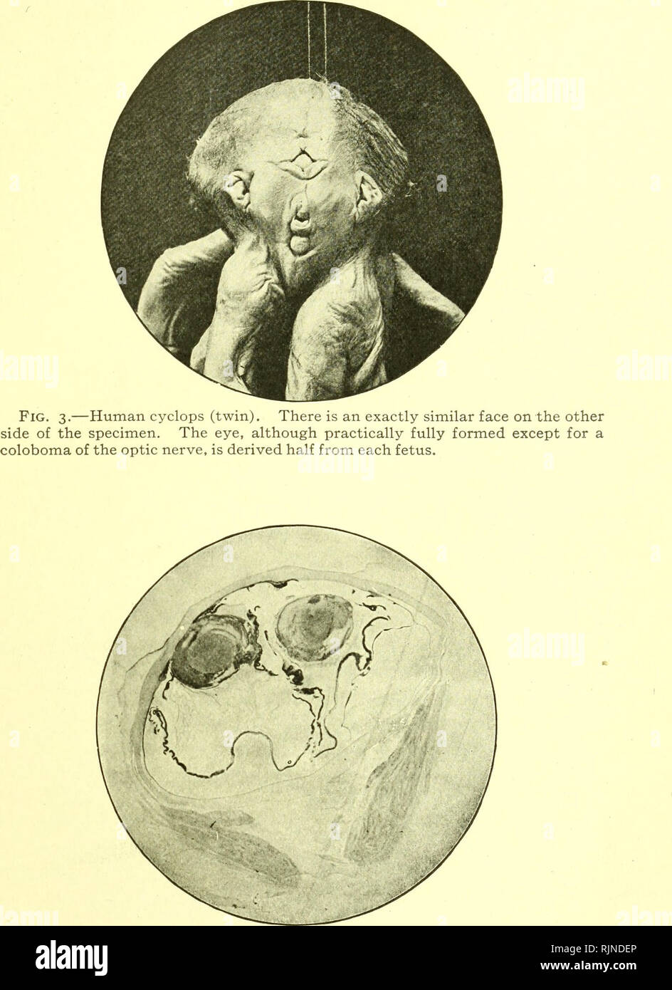 Cyclopia hi-res stock photography and images - Alamy