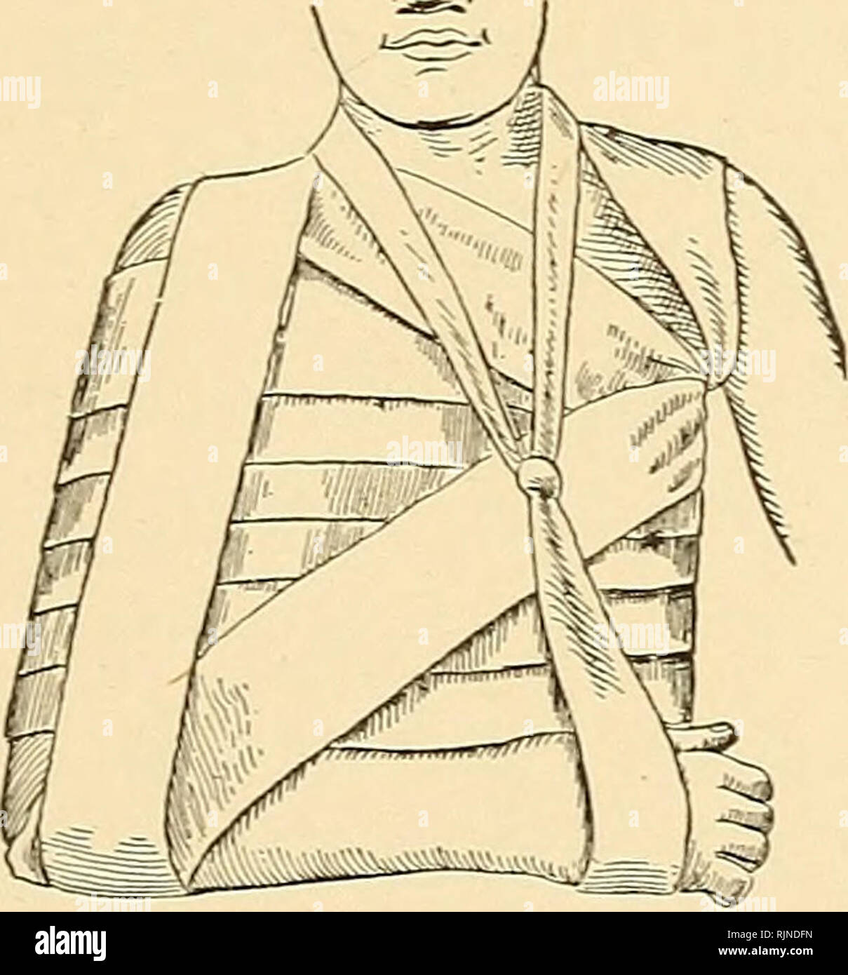 . Bacteriology and surgical technic for nurses. Nurses and nursing ...