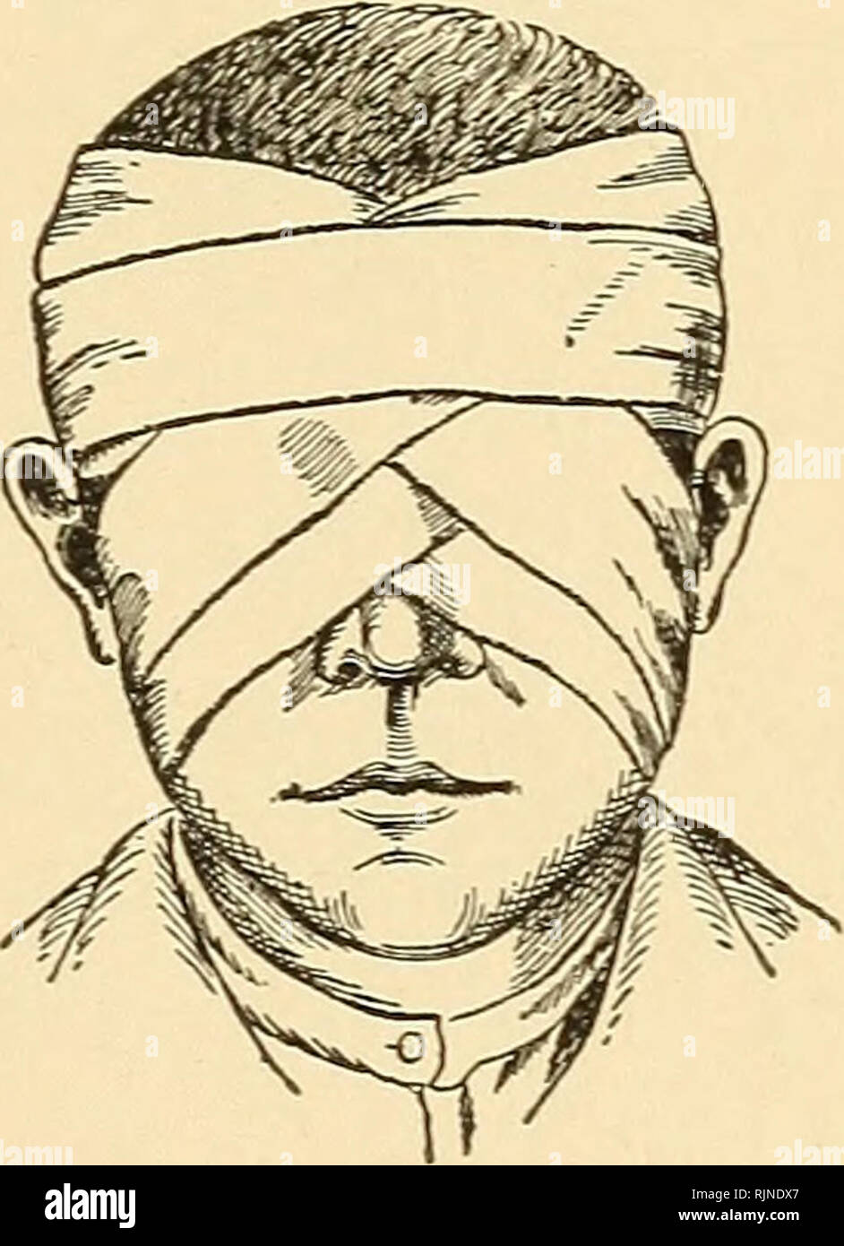 Recurrent bandage with one bandage hi-res stock photography and images ...