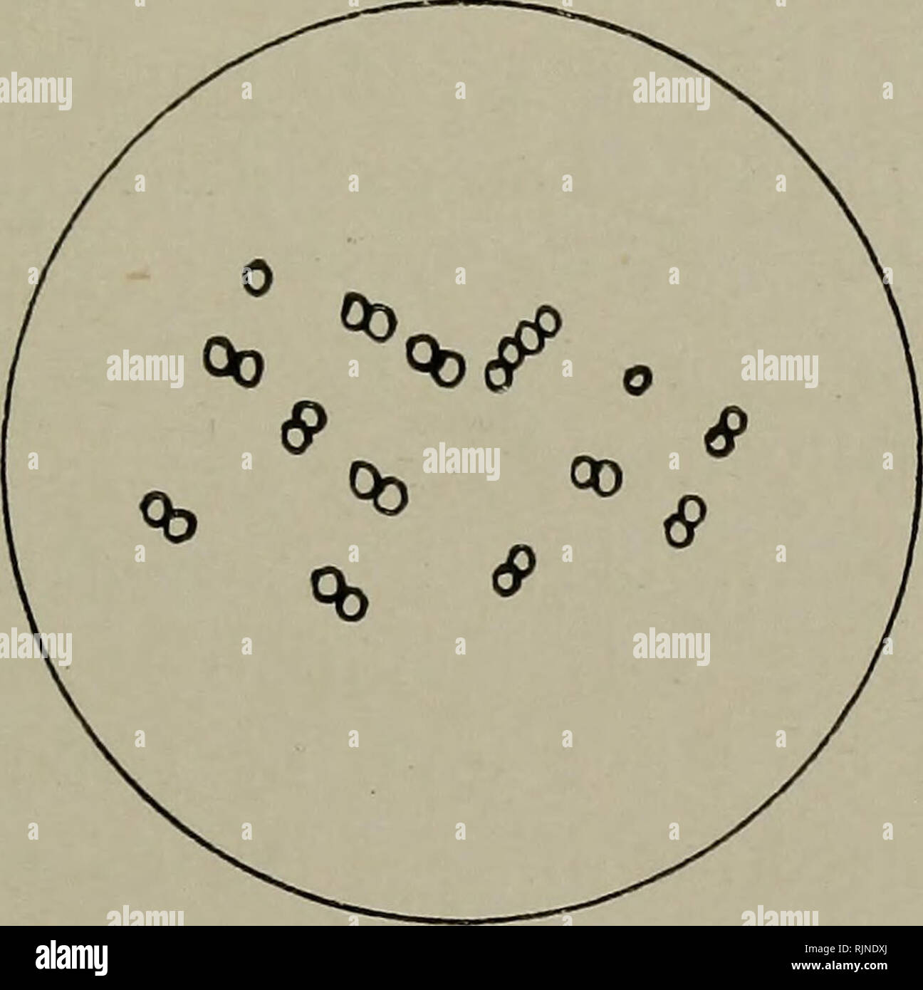 Friedlanders bacillus hi-res stock photography and images - Alamy