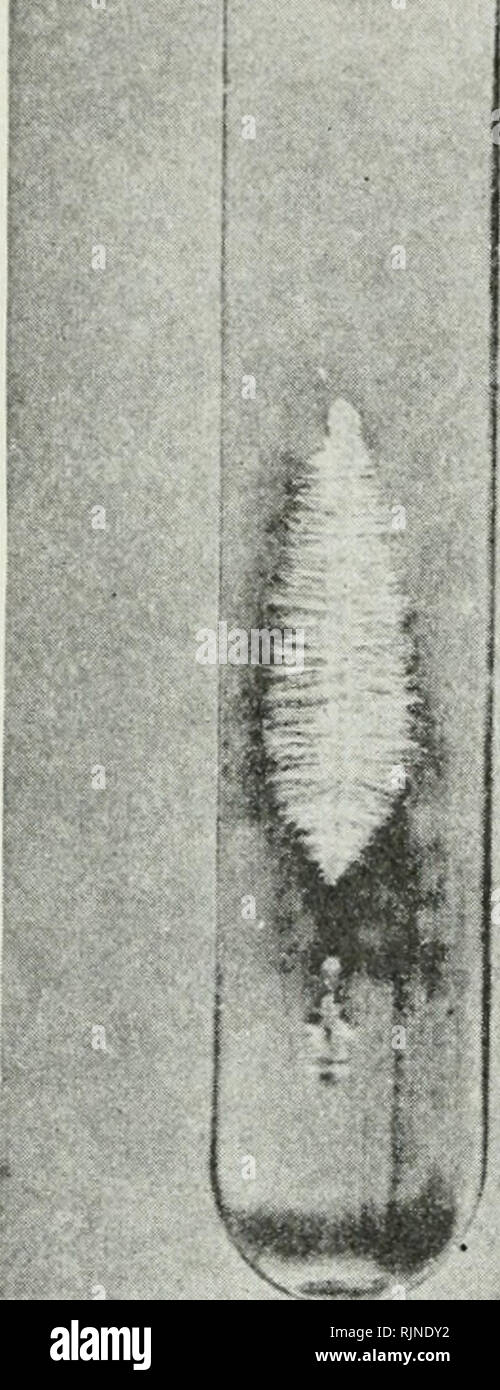 Putrefactive bacteria hi-res stock photography and images - Alamy