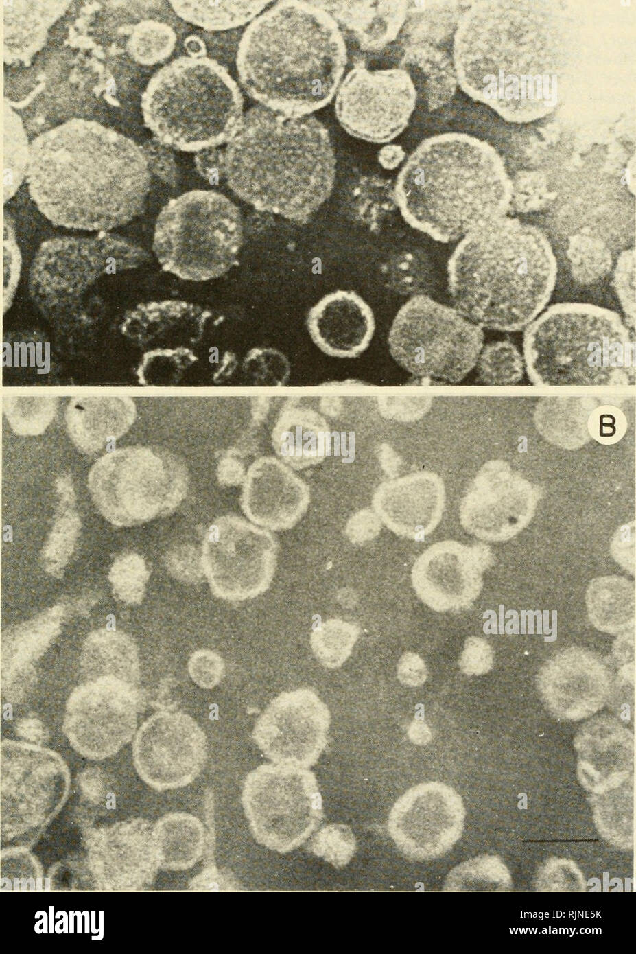 Negative staining bacteria hi-res stock photography and images - Alamy
