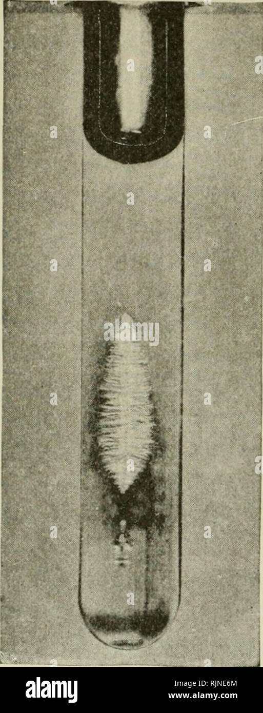 Putrefactive bacteria hi-res stock photography and images - Alamy
