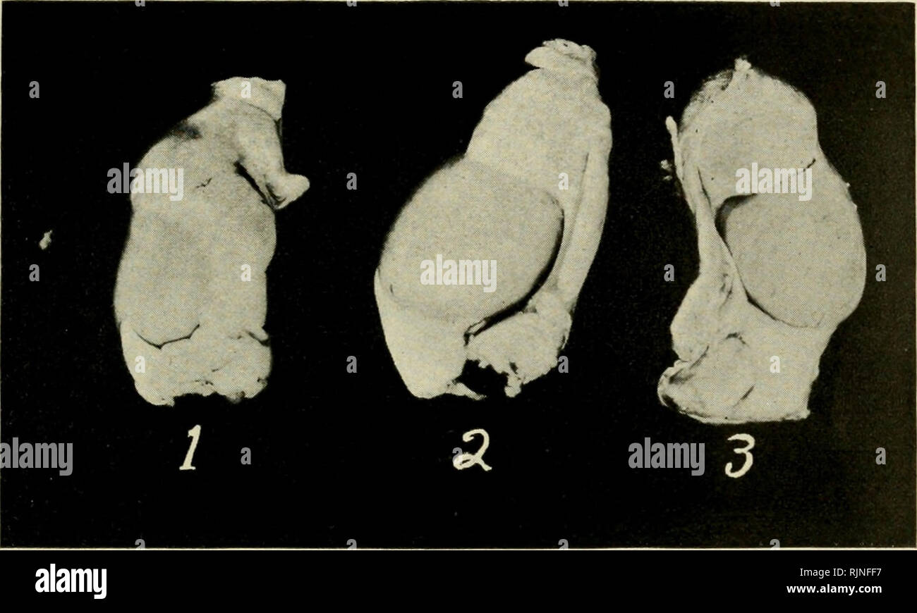 Placental injection hi-res stock photography and images - Alamy