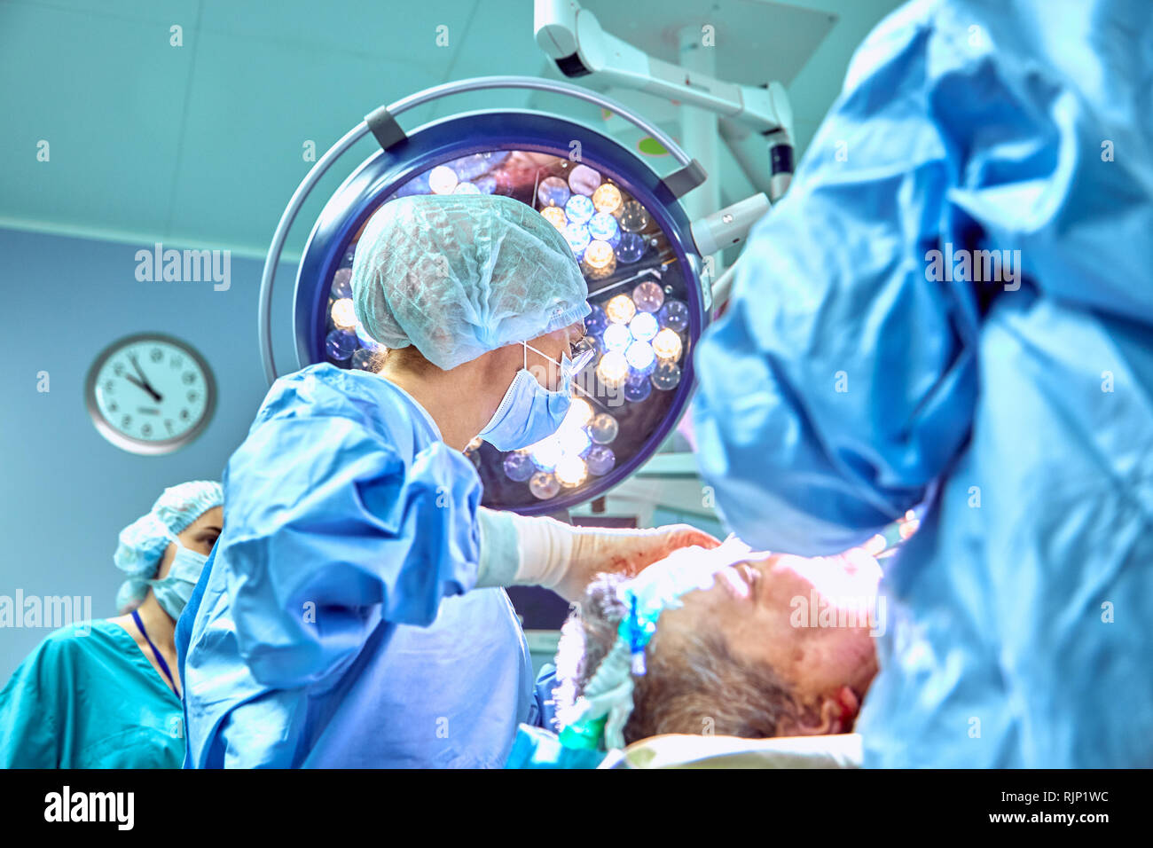 Chin reduction augmentation double chin removal plastic surgery ...