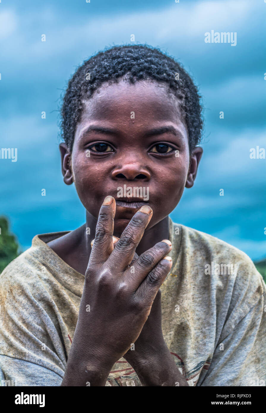 Malange / Angola - 12 08 2018: African boy, with expressive look on ...