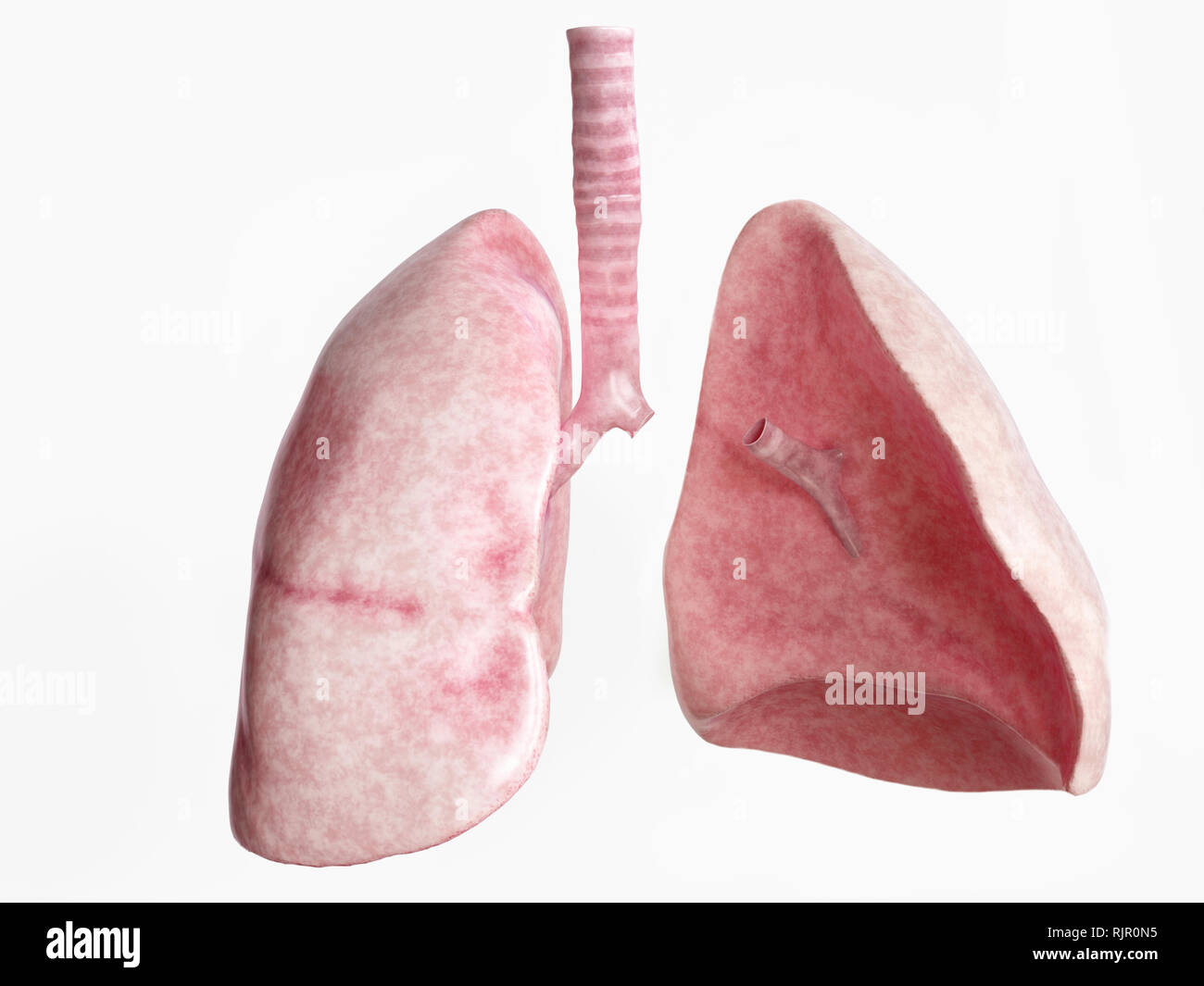 Tuberculosis lung x ray hi-res stock photography and images - Alamy