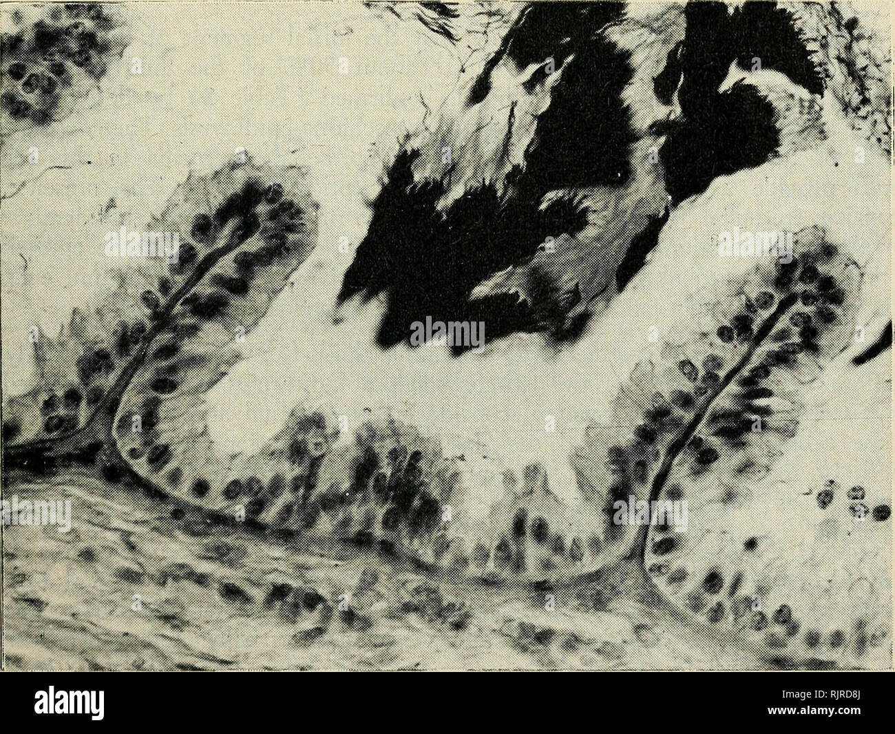 . The Australian zoologist. Zoology; Zoology; Zoology. EPIDIDYMIS OF ...