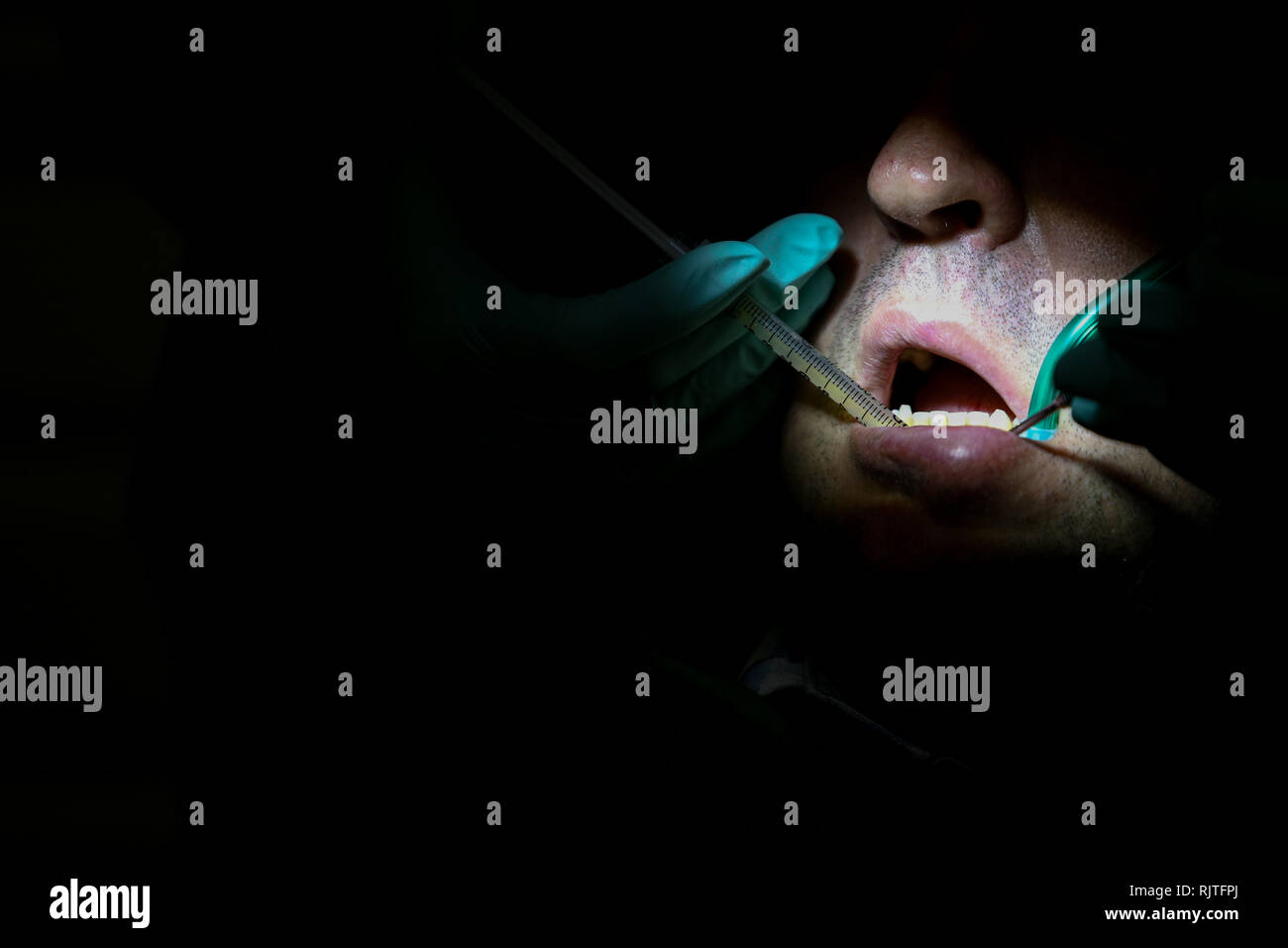 Details with the hands of a woman dentist, with surgical gloves ...