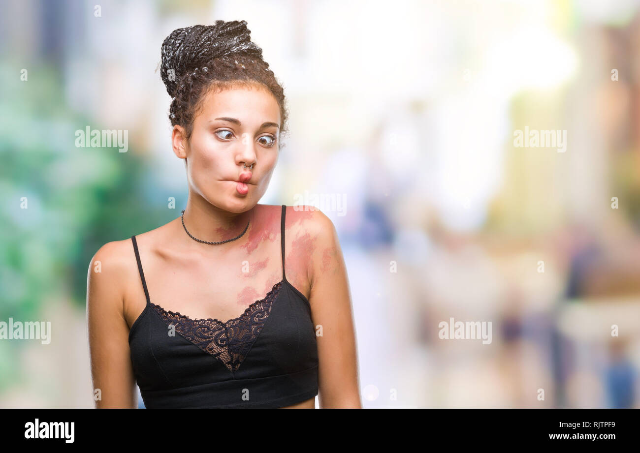 Young braided hair african american with pigmentation blemish birth ...