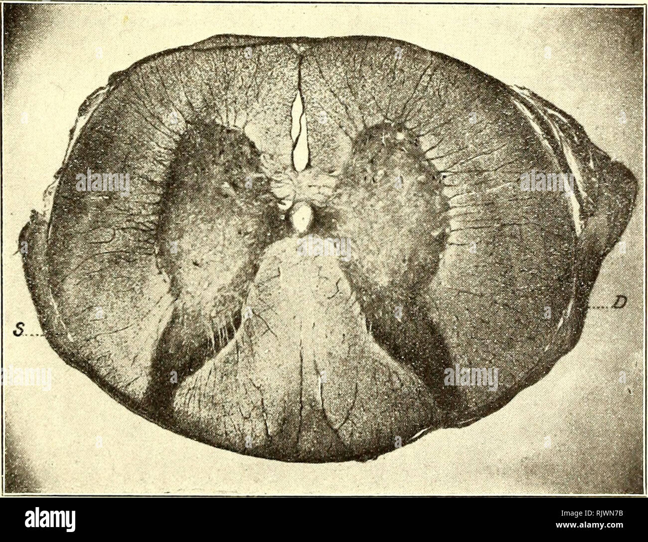 Differenze di sviluppo hi-res stock photography and images - Alamy