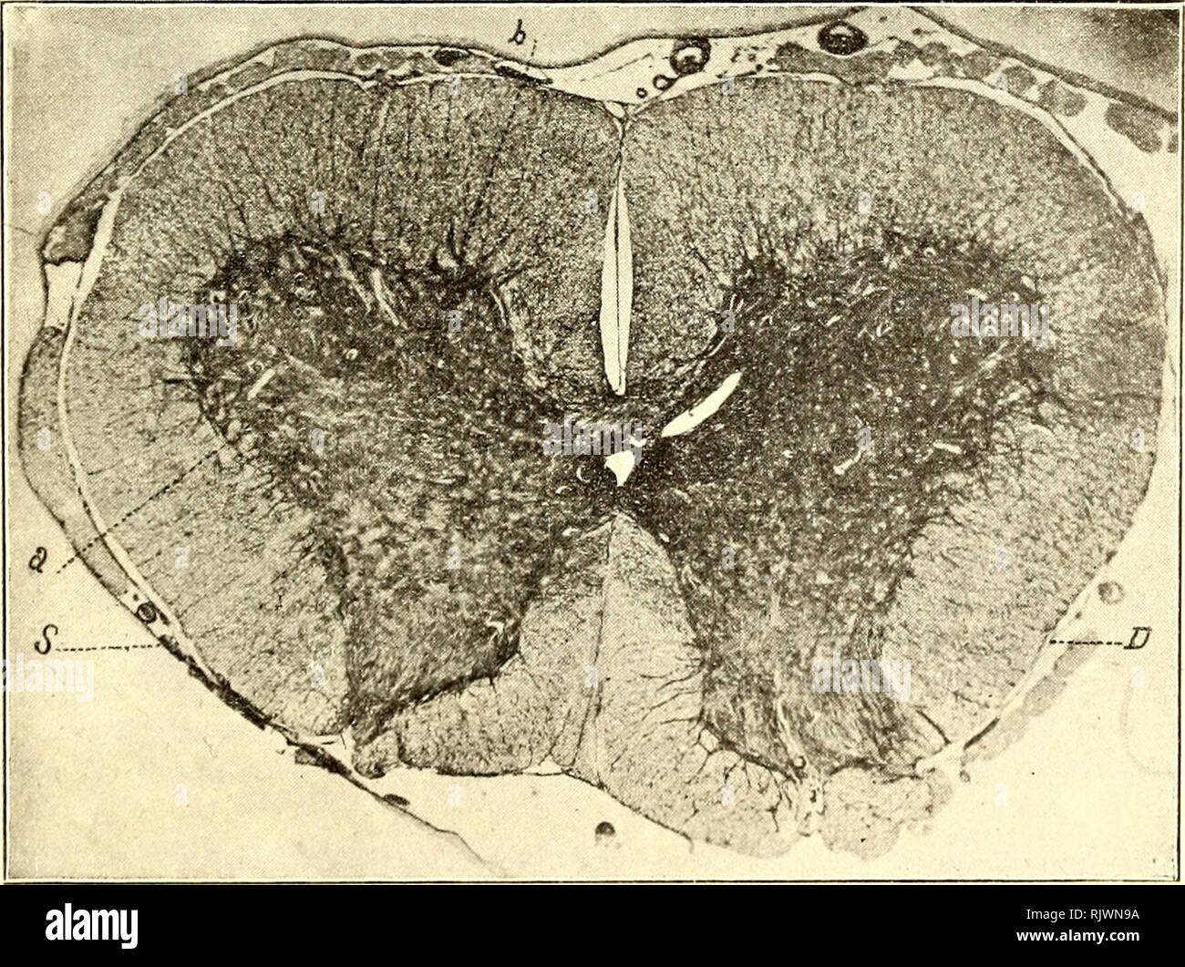 Midollo spinale lombare hi-res stock photography and images - Alamy