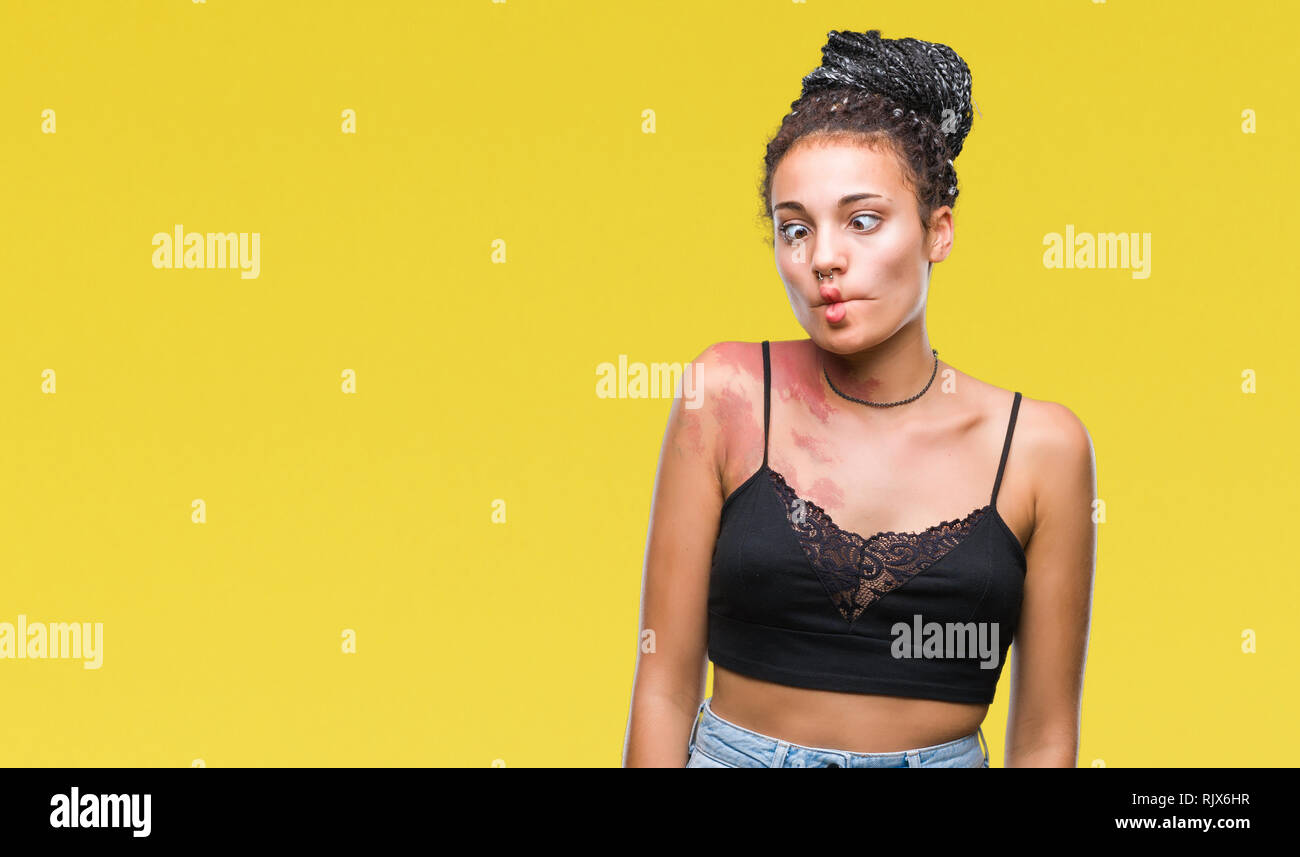 Young braided hair african american with pigmentation blemish birth ...