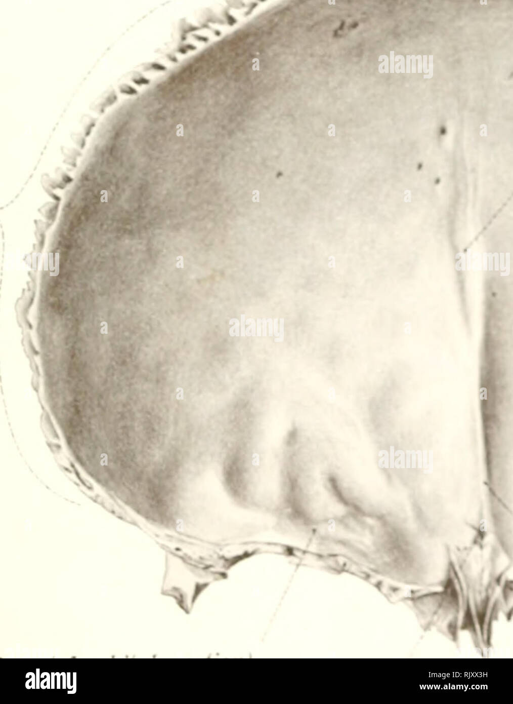 Superior Temporal Line