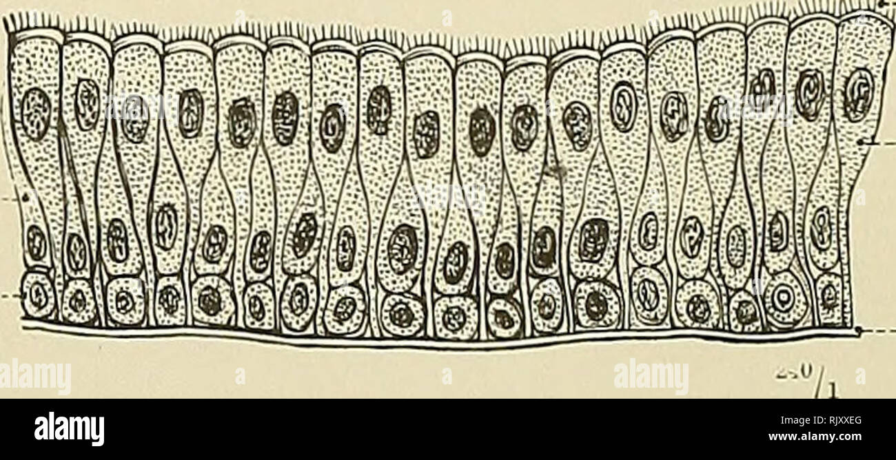 Transitional epithelium hi-res stock photography and images - Alamy