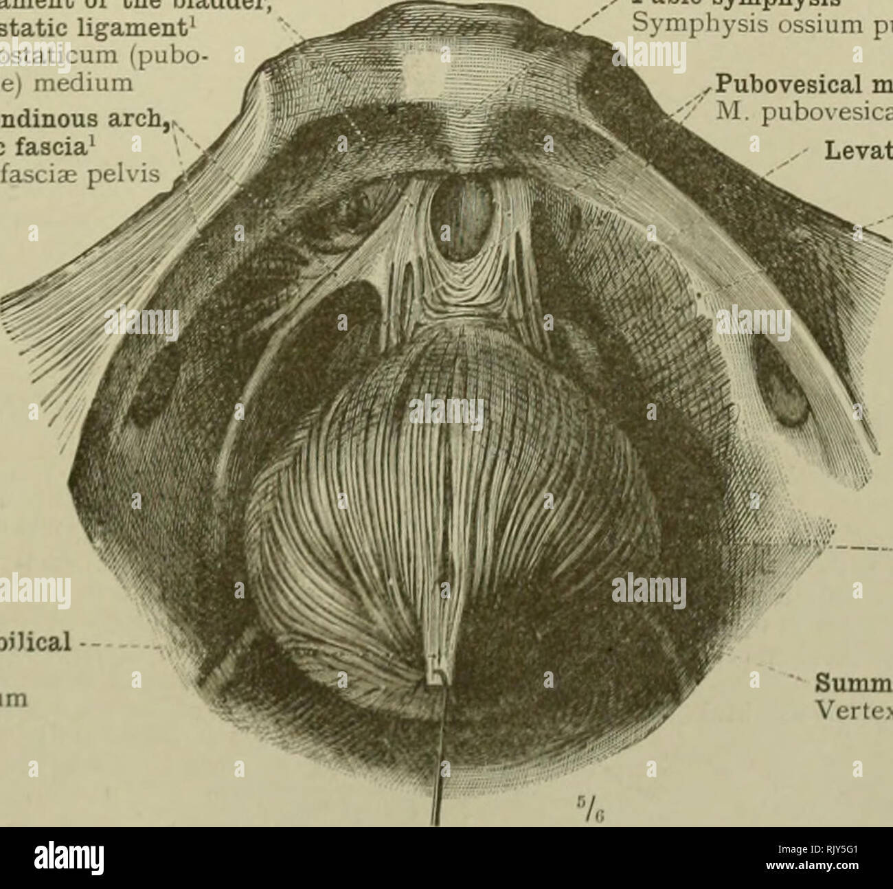 Medial Umbilical Ligament Cadaver