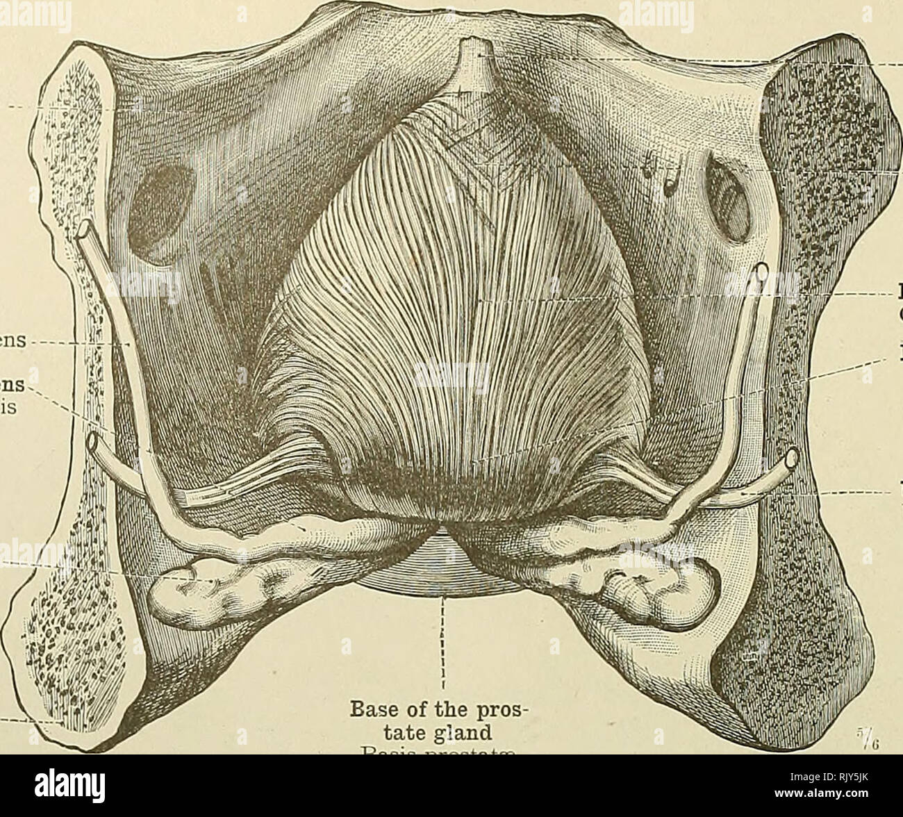 Urachus Median Umbilical Ligament