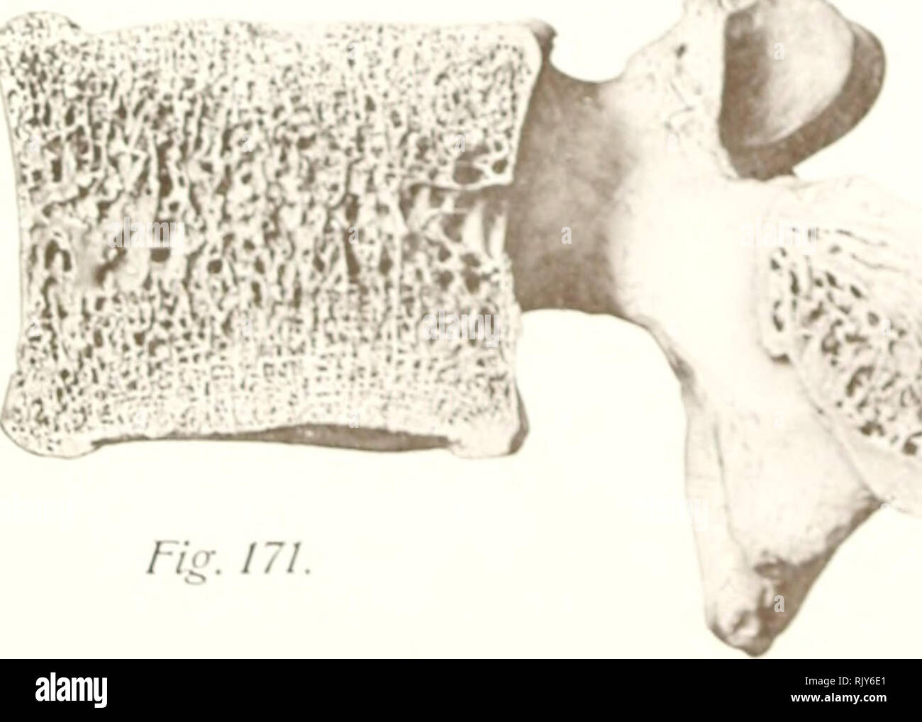Longitudinal section of tibia hi-res stock photography and images - Alamy
