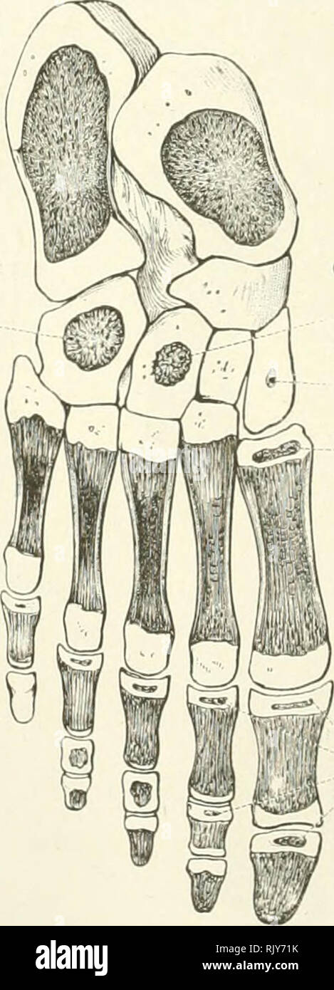 First metatarsal bone hi-res stock photography and images - Alamy