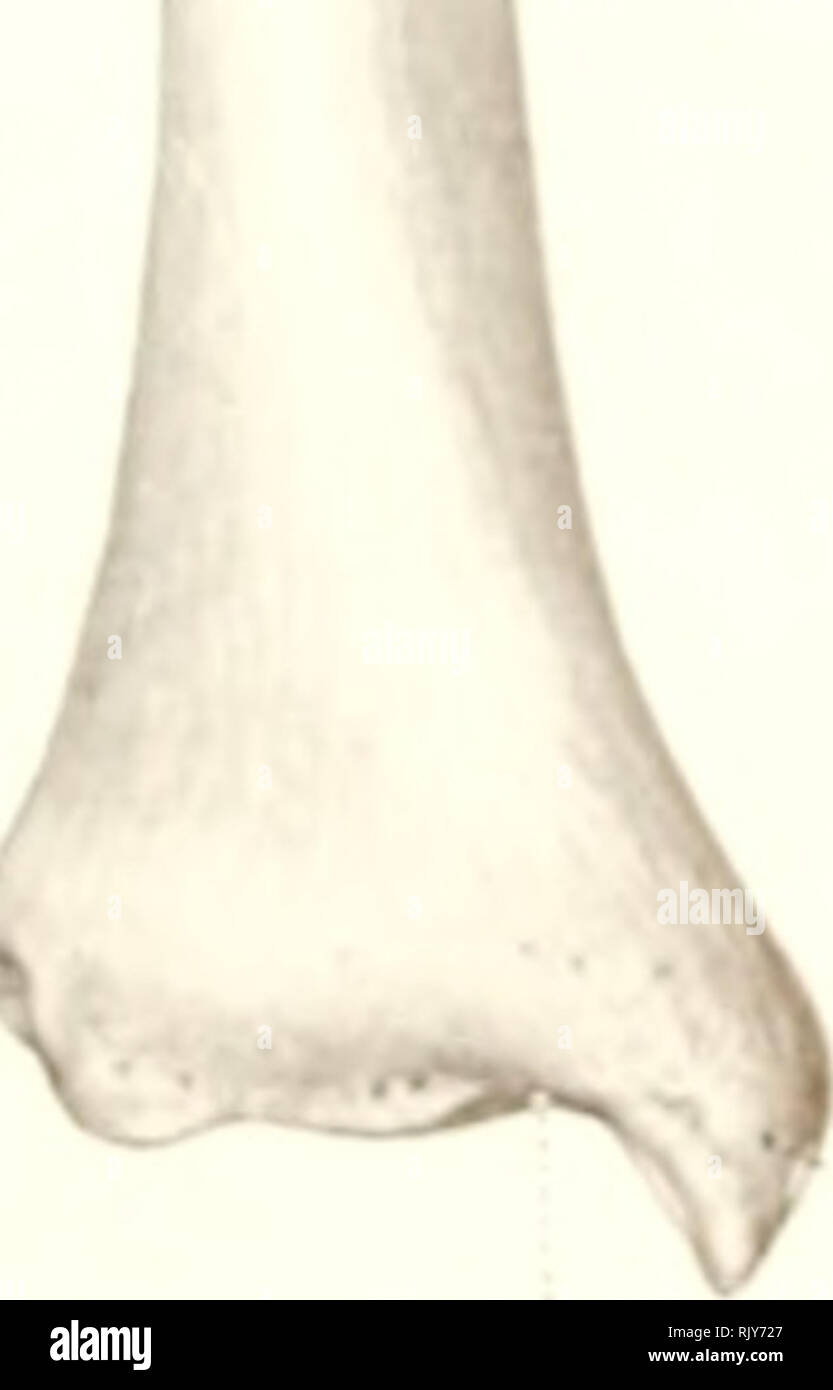 Fibular Notch Of Tibia