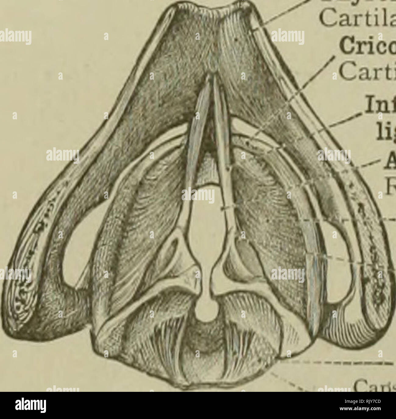 Corniculate Cartilage Dissection