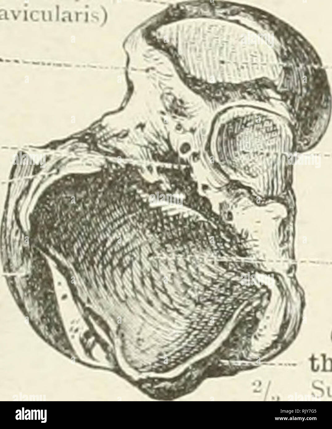 Trochlear Tubercle