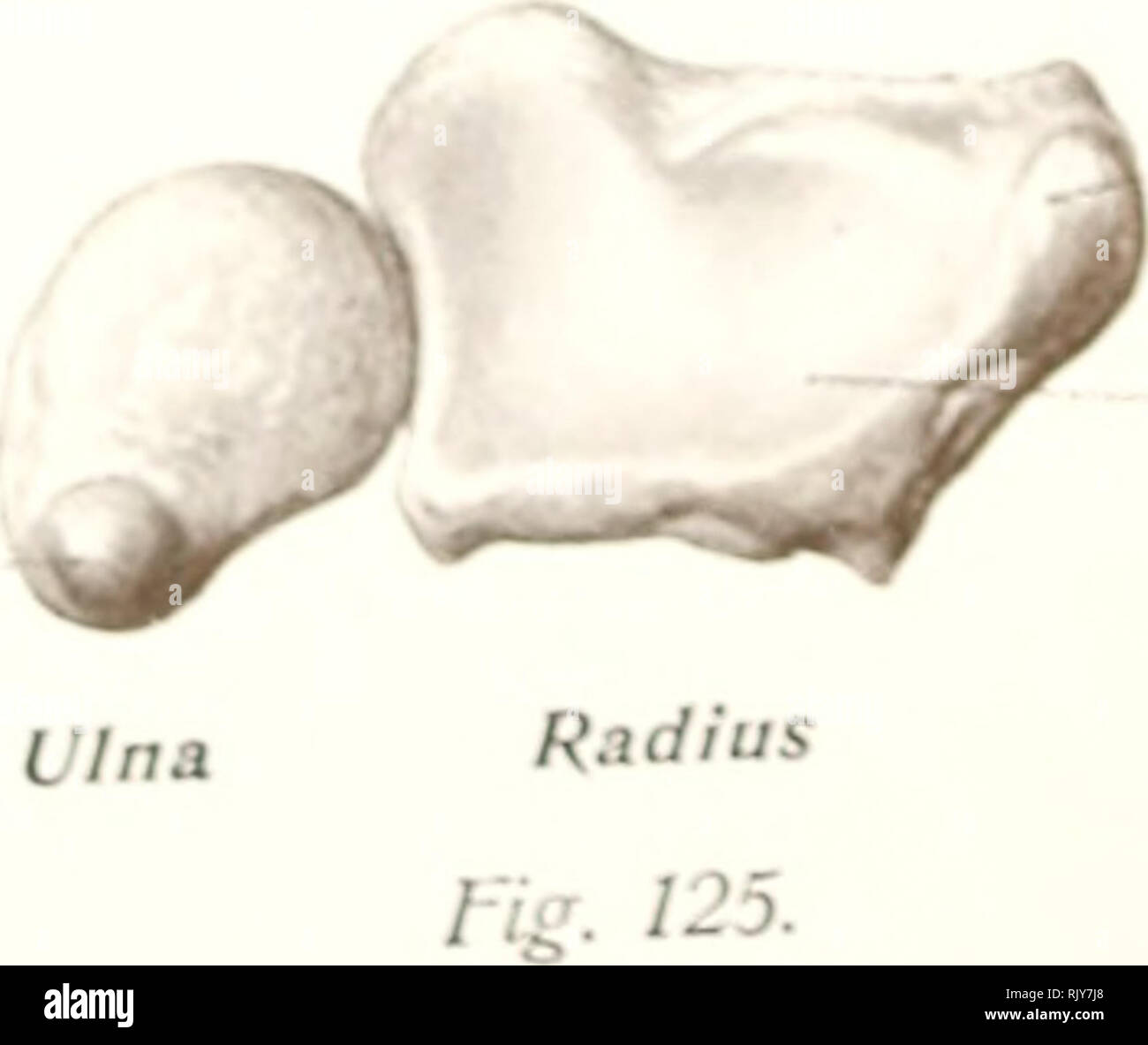 Styloid process of ulna hi-res stock photography and images - Alamy
