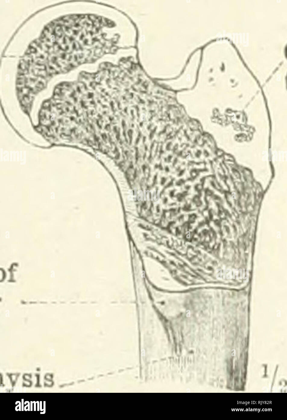 Diaphysis Stock Photos & Diaphysis Stock Images - Alamy