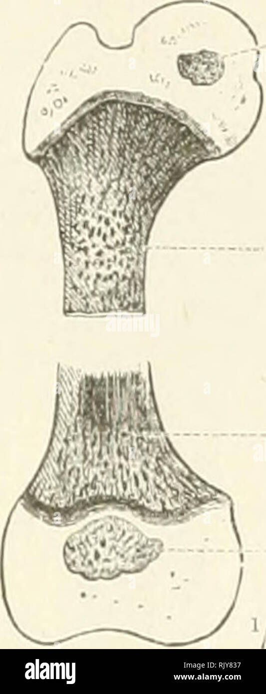 Epiphysial High Resolution Stock Photography and Images - Alamy