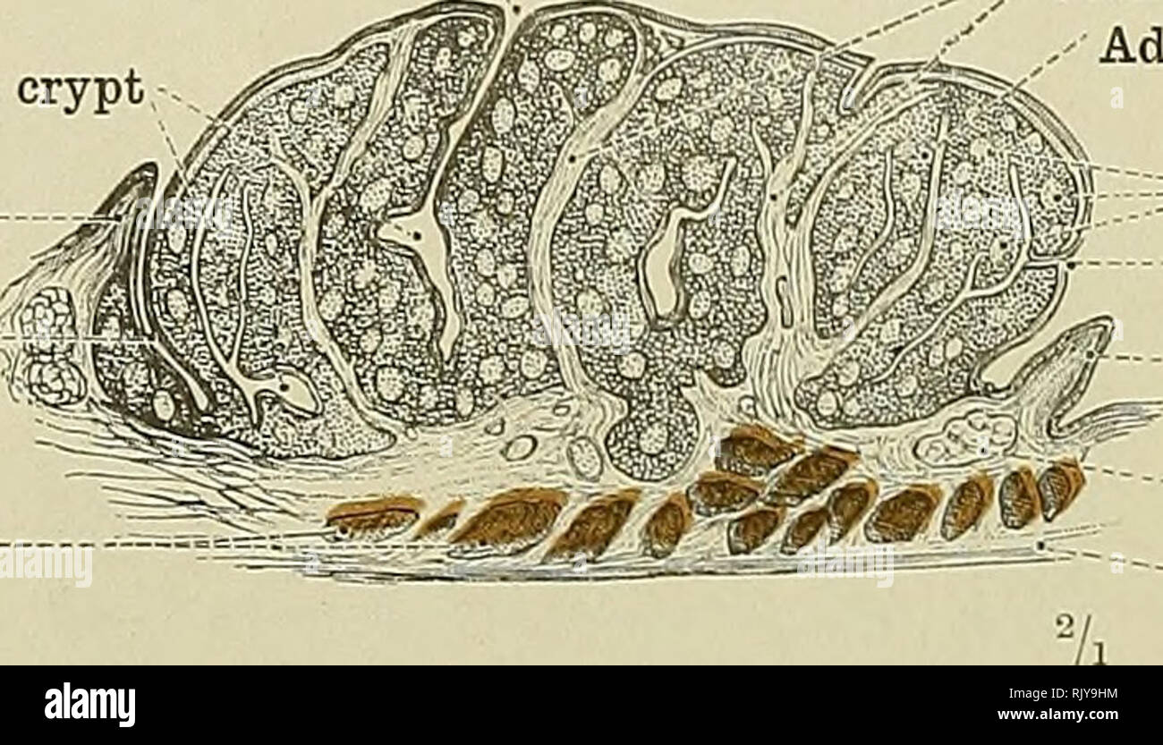 Tonsillar crypt hi-res stock photography and images - Alamy
