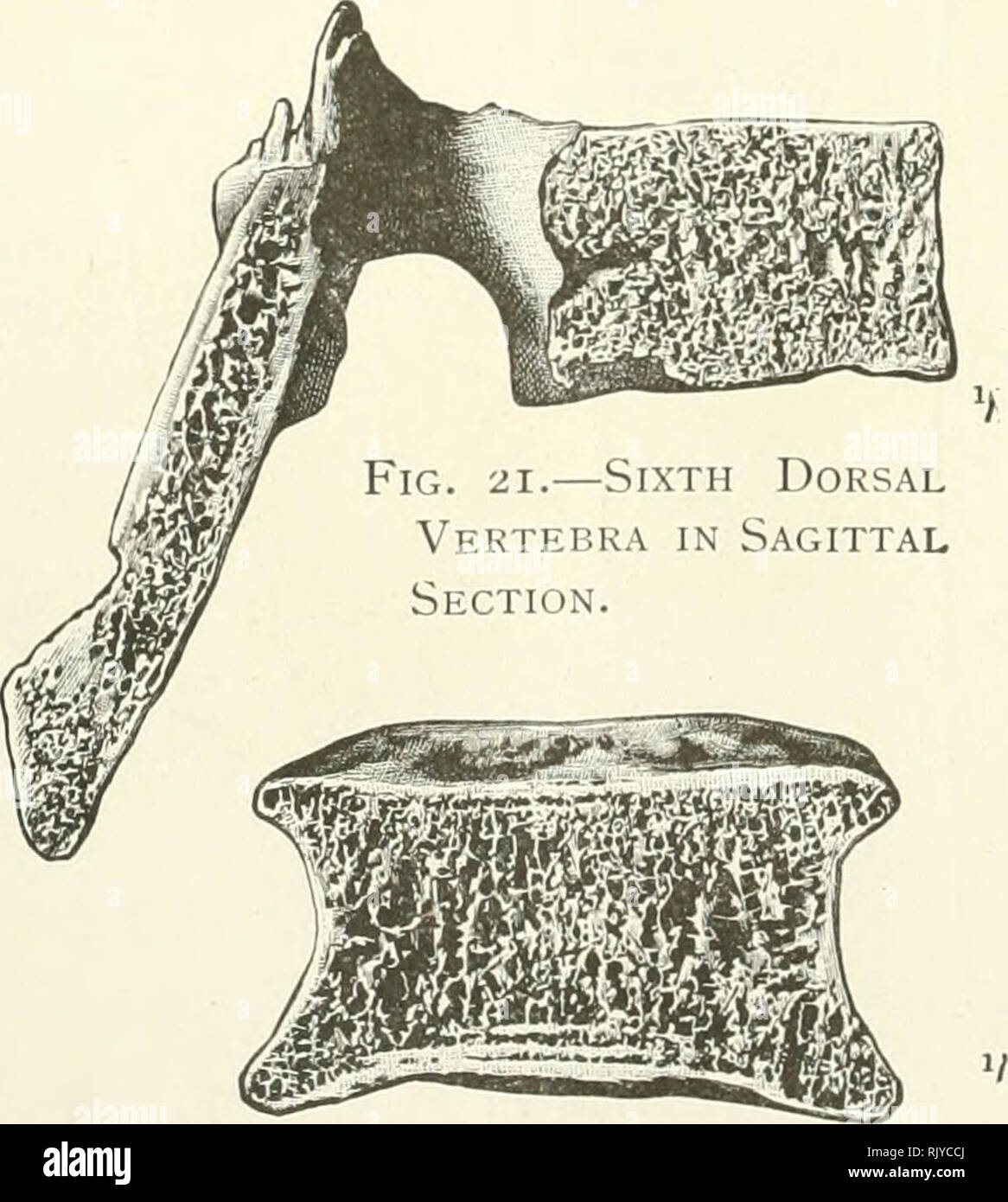 Substantia spongiosa hi-res stock photography and images - Alamy