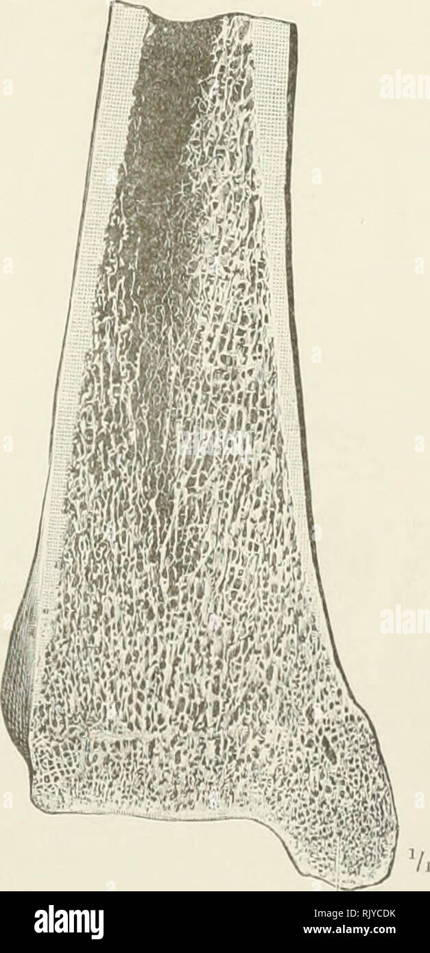 Substantia spongiosa ossium hi-res stock photography and images - Alamy