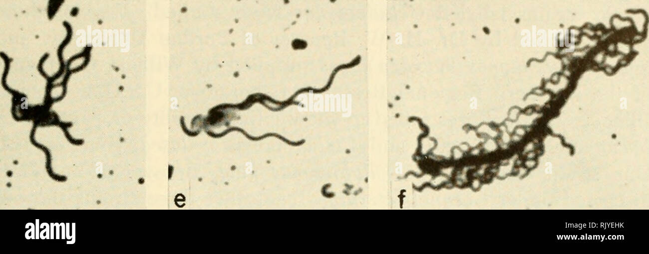 Flavobacterium hi-res stock photography and images - Alamy