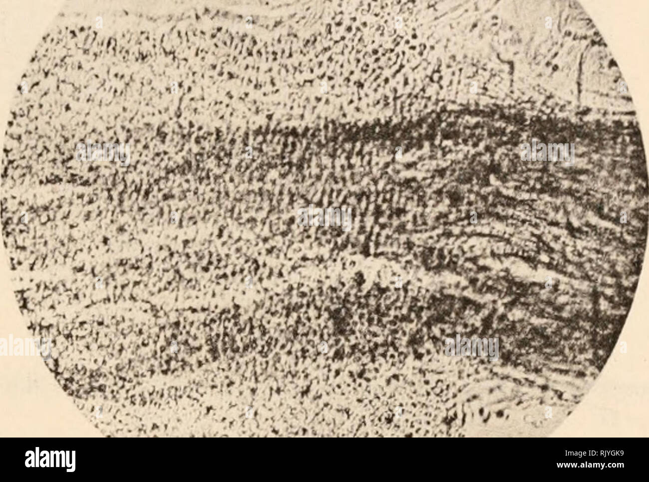 Teigne du cuir chevelu hi-res stock photography and images - Alamy