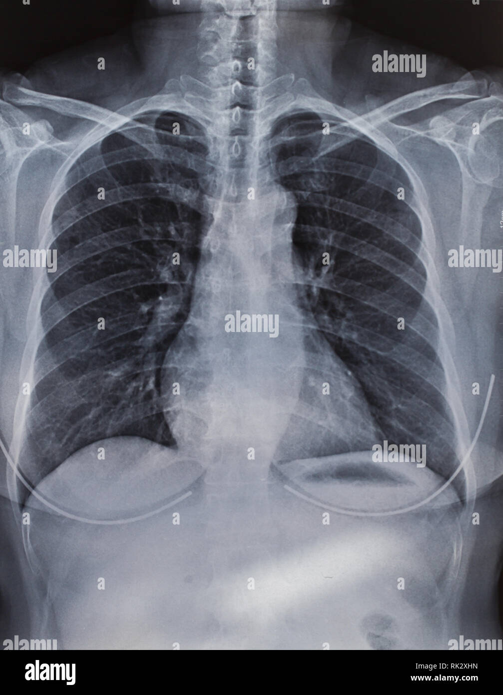 Perspective photo of human chest Stock Photo - Alamy