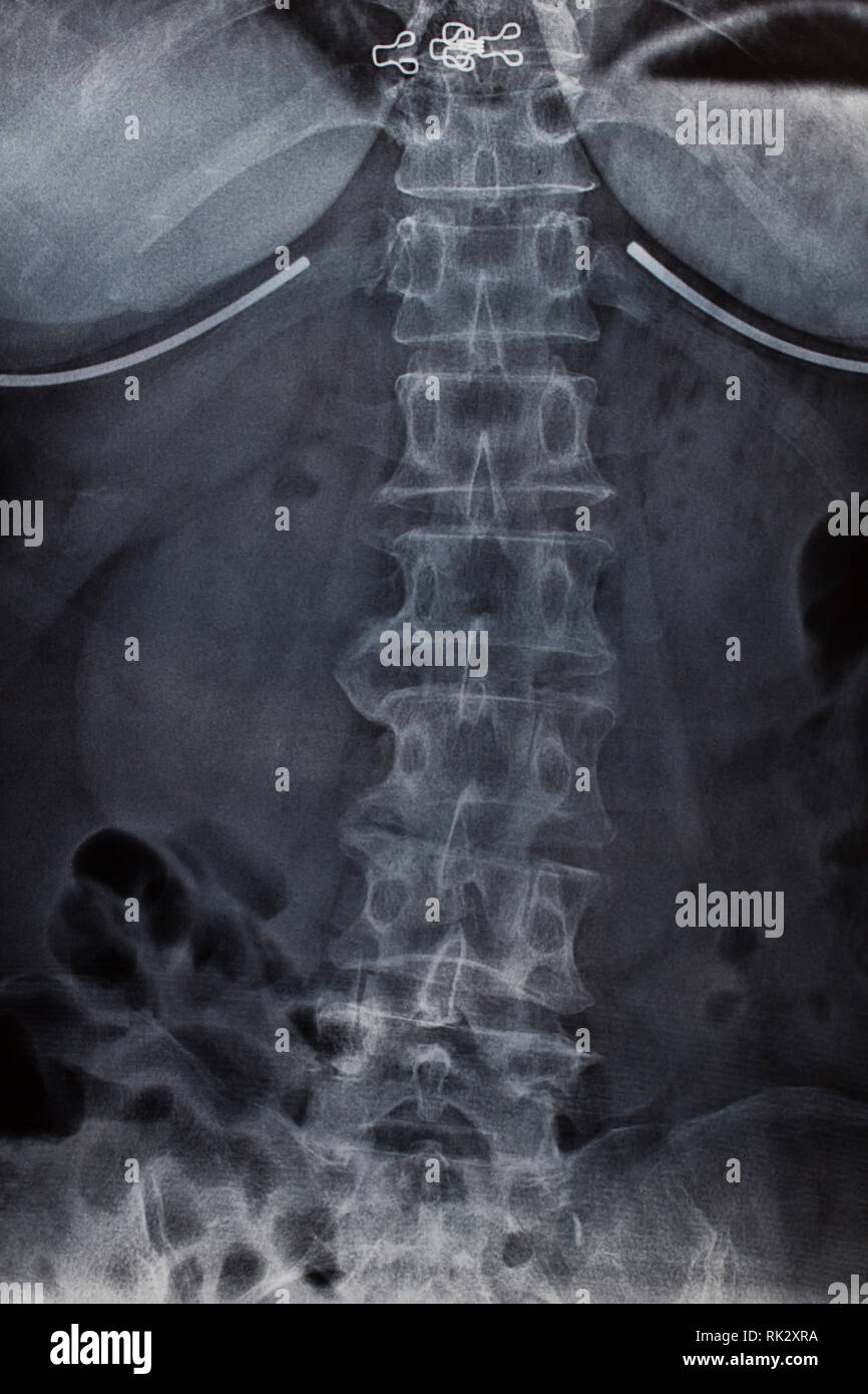 Perspective photo of human spine Stock Photo - Alamy