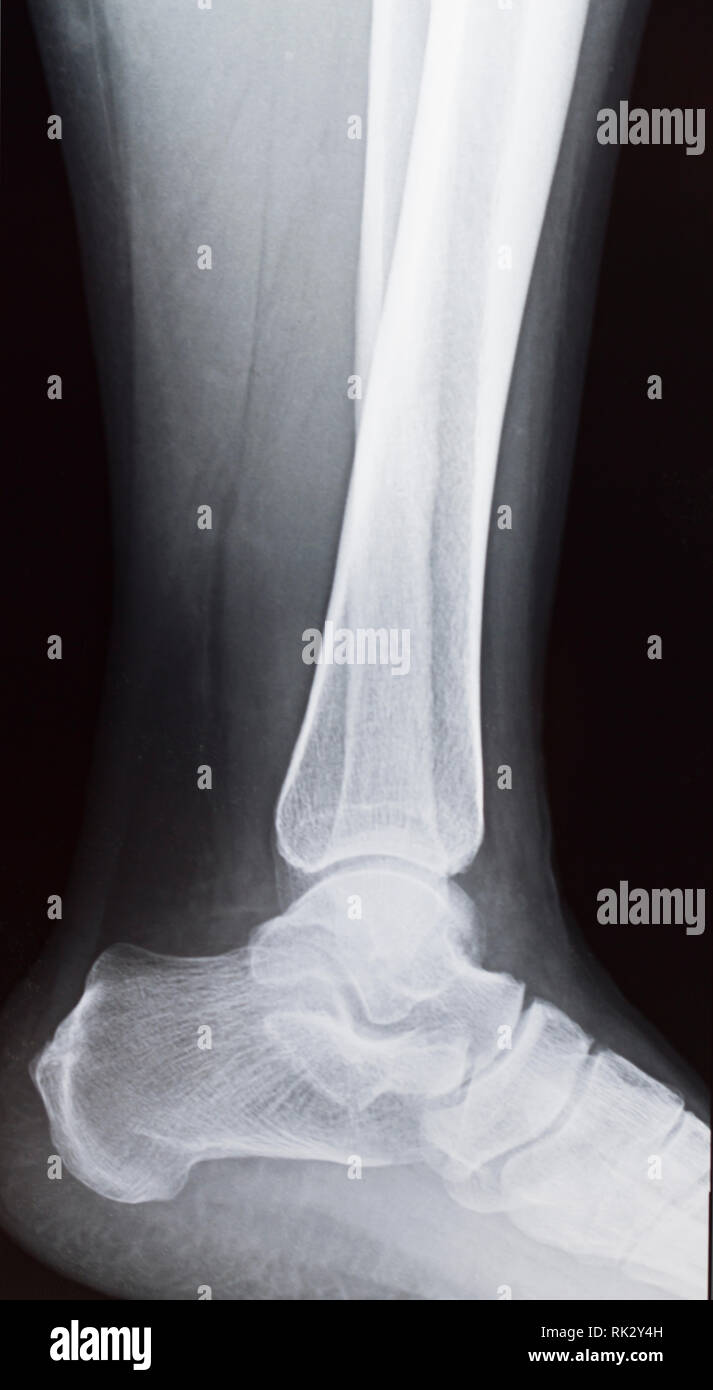 Human transparent anatomy hi-res stock photography and images - Alamy