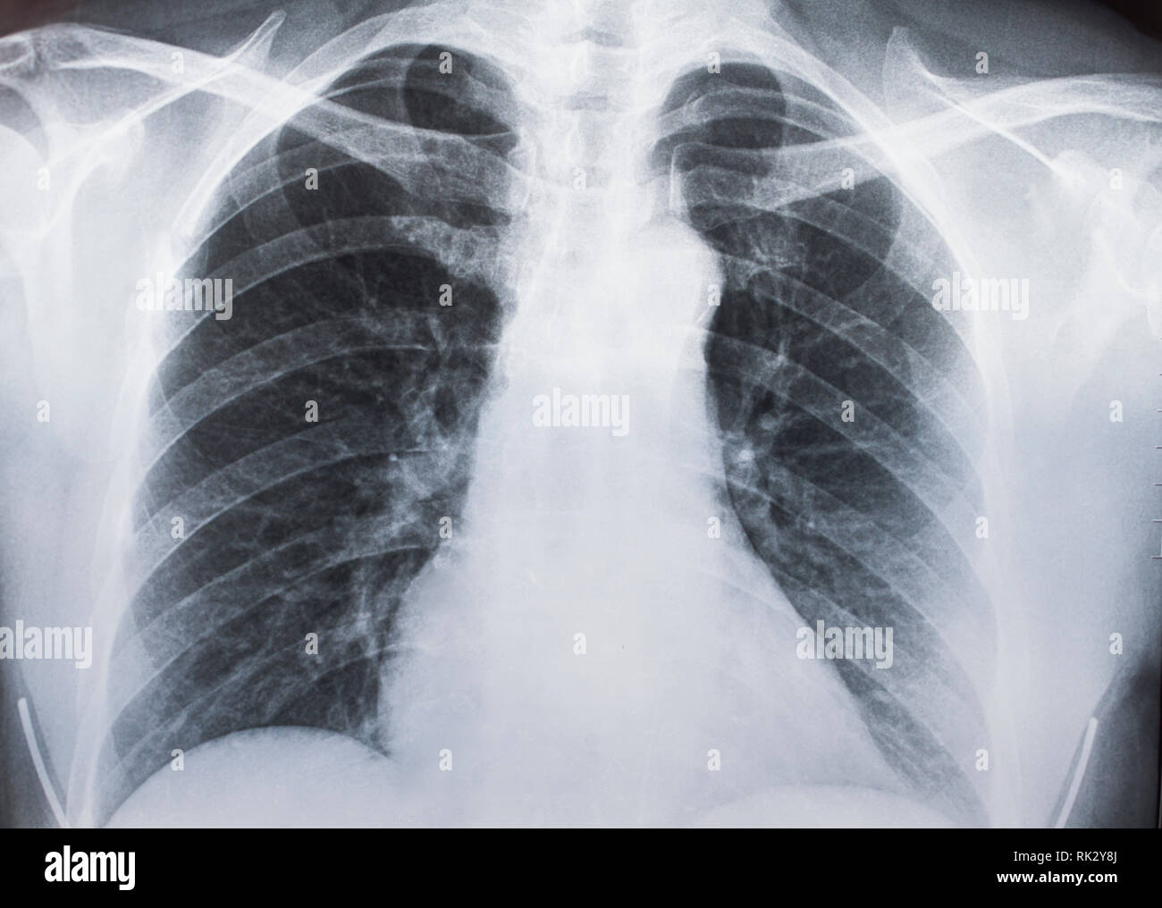 Perspective photo of human chest Stock Photo - Alamy