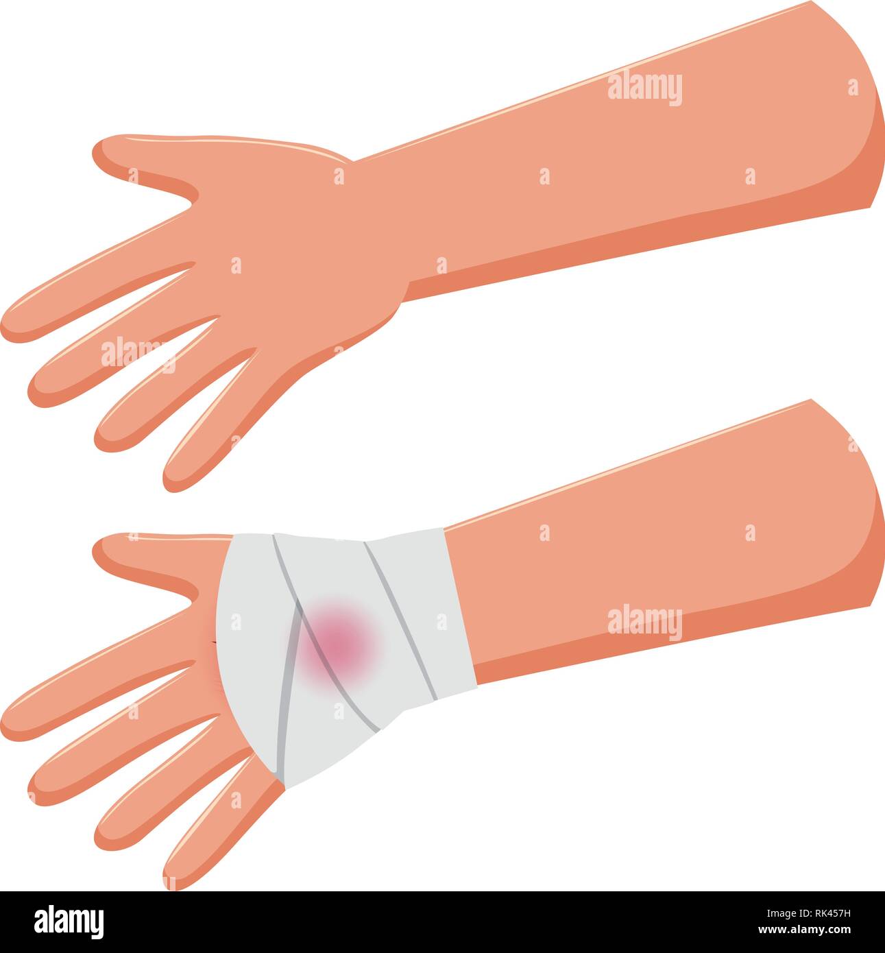Set of arms and hand bandage illustration Stock Vector Image & Art - Alamy