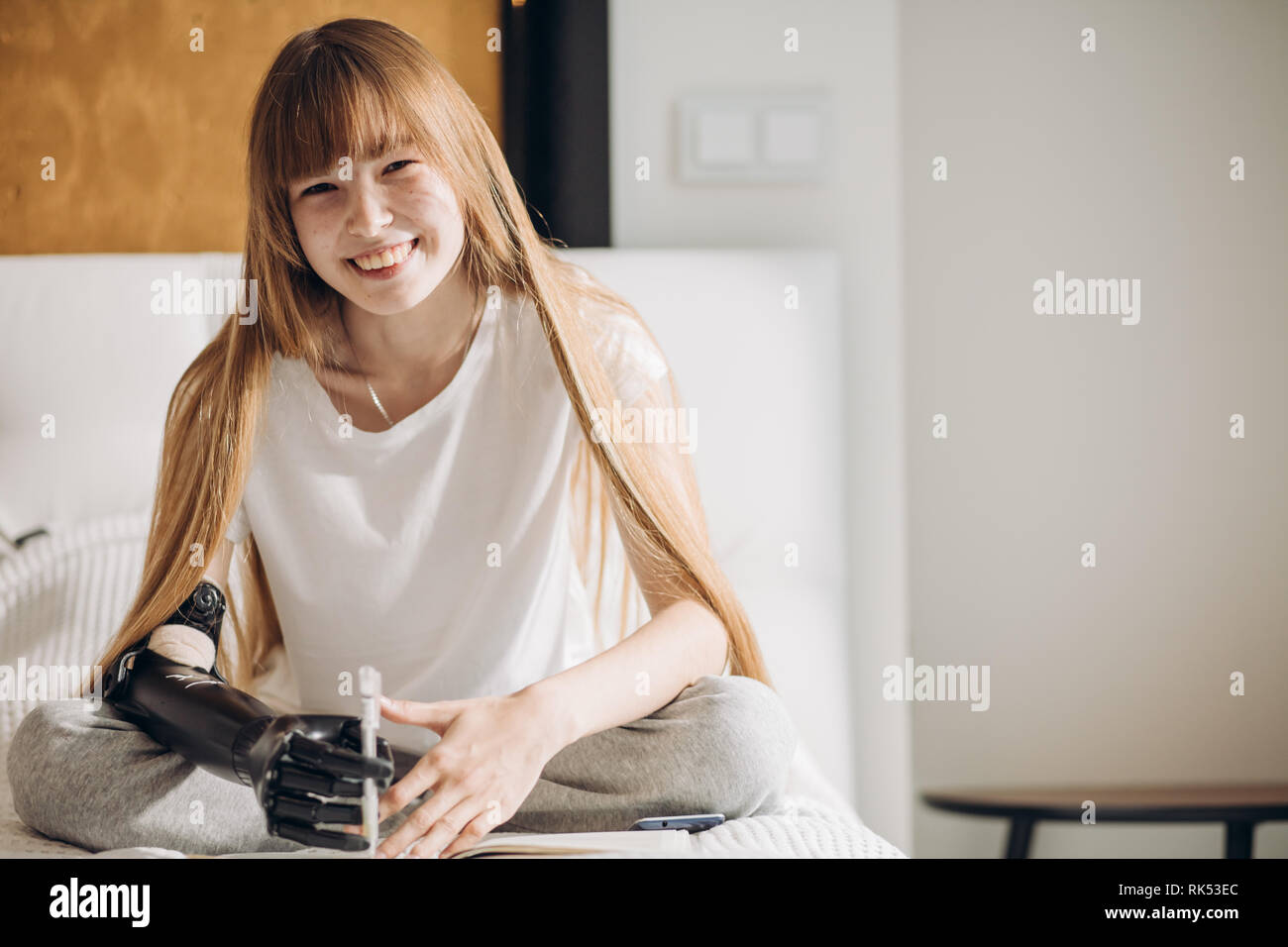 Photo of smiling cheerful girl with prosthetic leg arm looking at the ...