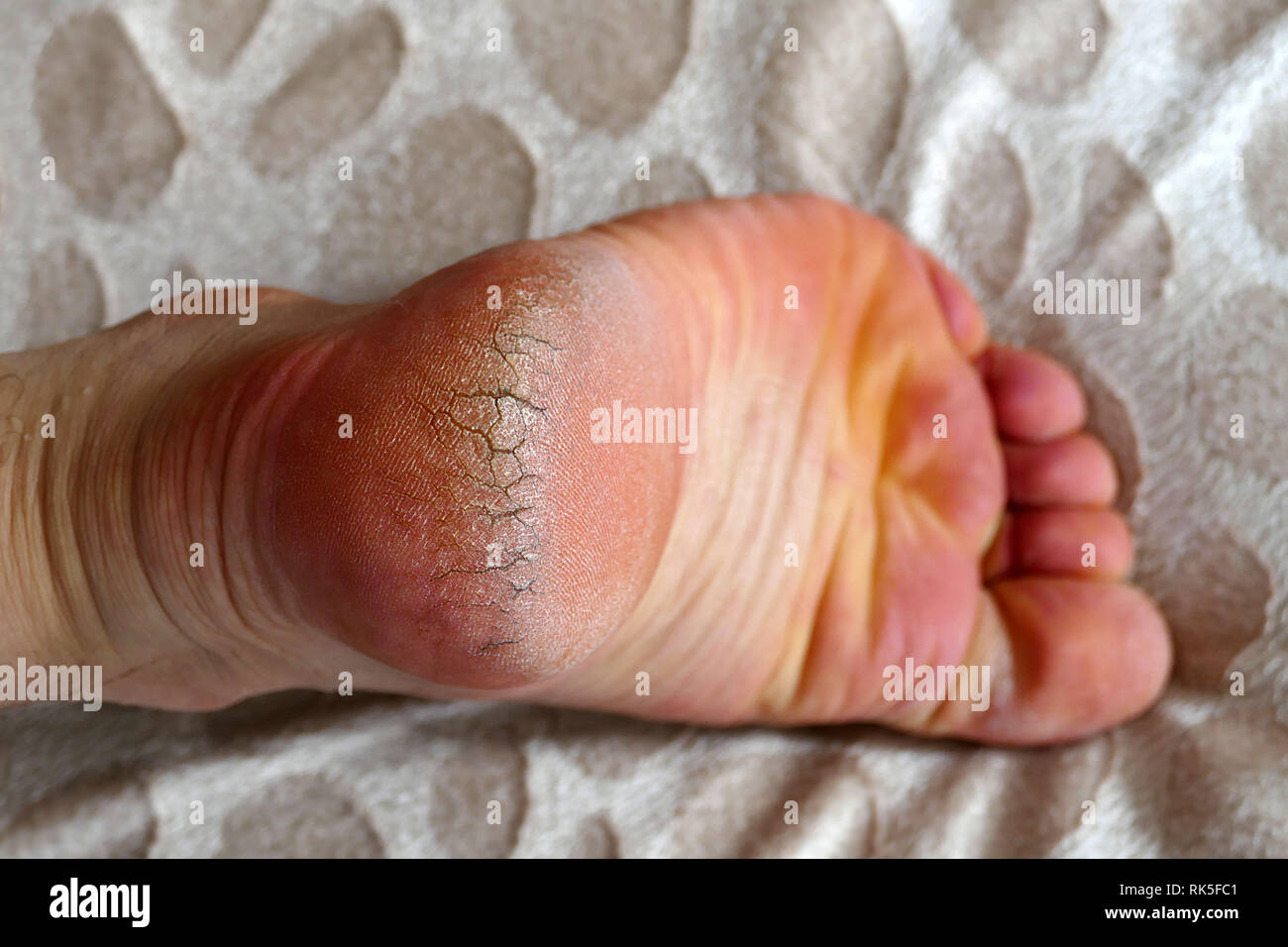 Dermatology pictures hi-res stock photography and images - Alamy