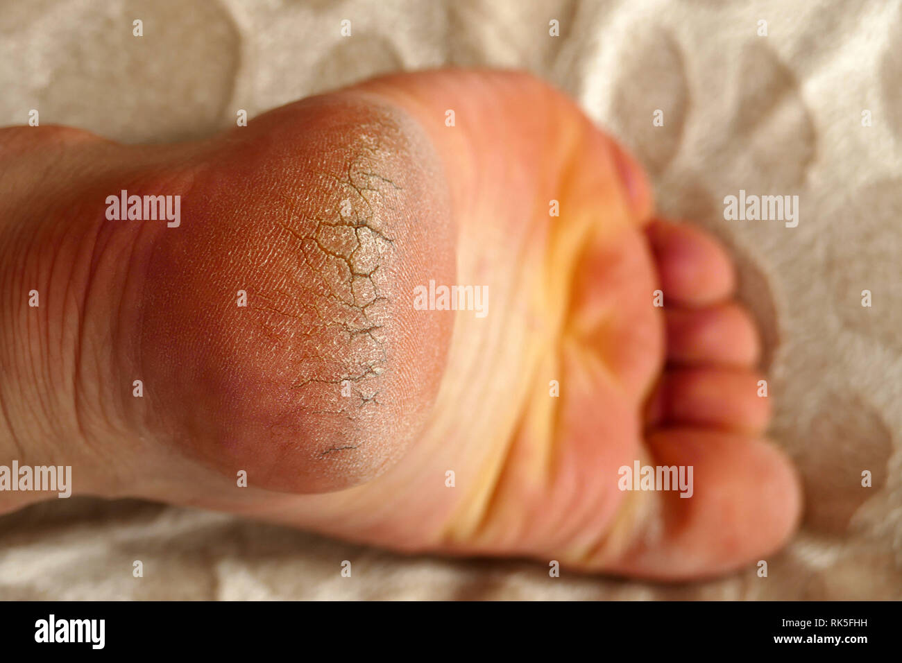 Dermatology pictures hi-res stock photography and images - Alamy