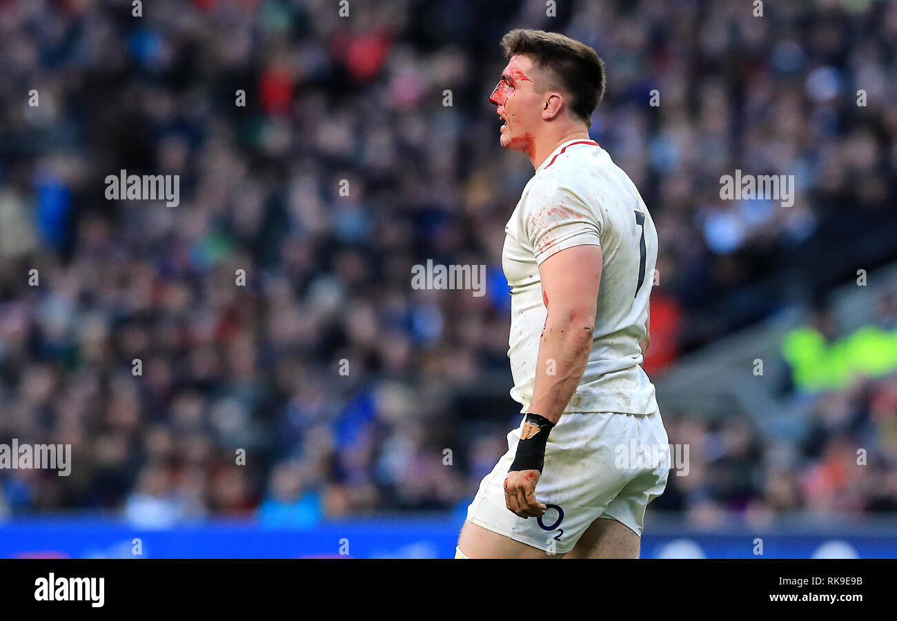 Tom curry with blood injury hi-res stock photography and images - Alamy