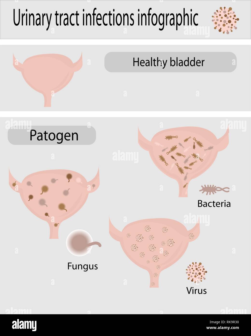 Urinary tract infection patogen bacteria, fungus and virus infographic ...